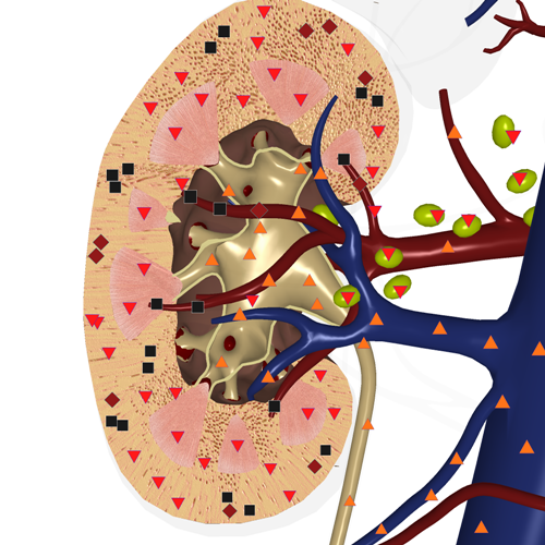NLS semiotics of acute pyelonephritis | NLS Diagnostic
