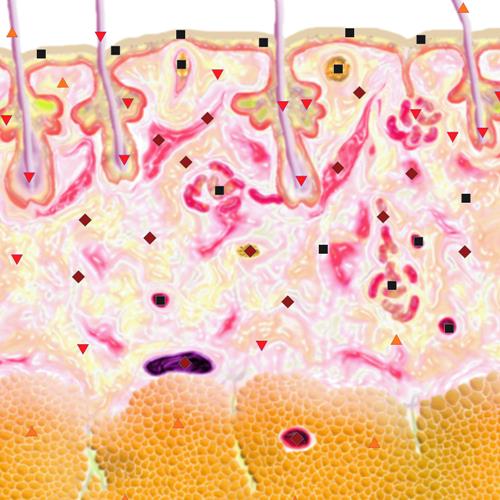 Possibilities of NLS-study methods in examination of certain skin ...