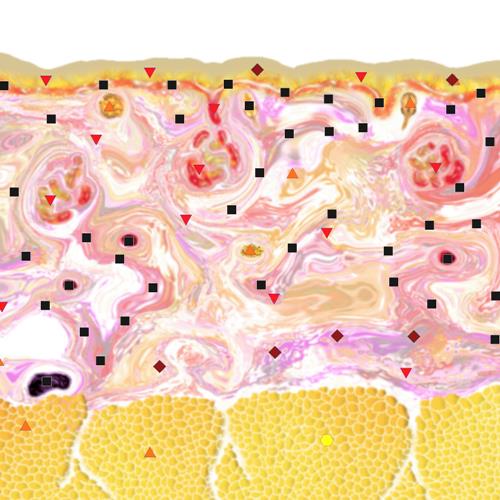 Possibilities of NLS-study methods in examination of certain skin ...