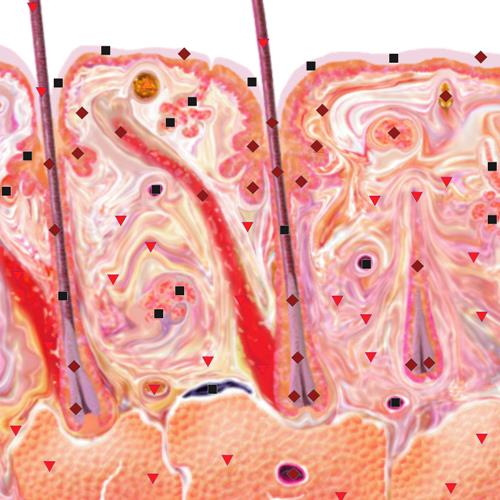 Possibilities of NLS-study methods in examination of certain skin ...