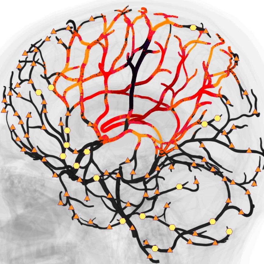 NLS-method in vascular pathology diagnosis | NLS Diagnostic